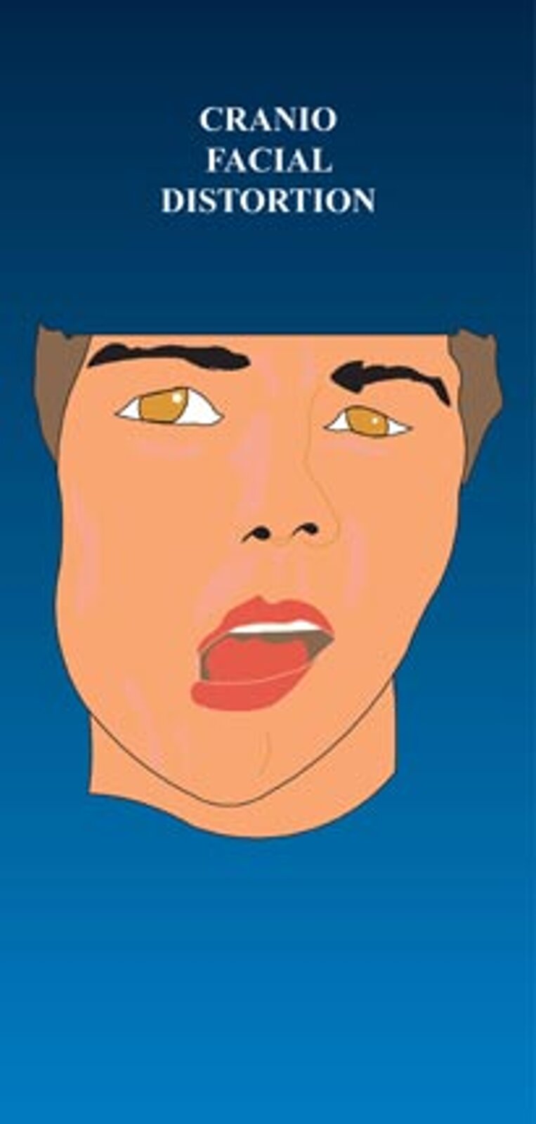 Cranio-Facial Distortion - Pack of 100 | SOTO Australia