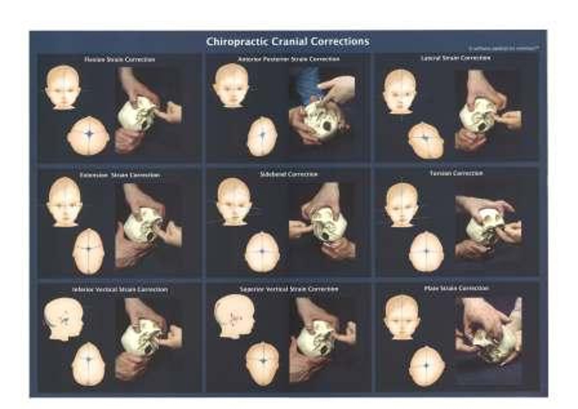 Cranial Corrections Chart (S Williams) | SOTO Australia
